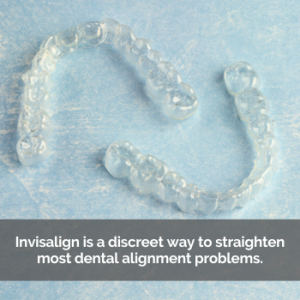What Is the Difference Between Plaque and Calculus? - Dental Partners ...