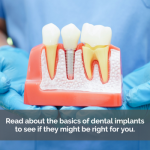 What Is the Difference Between Plaque and Calculus? - Dental Partners ...