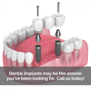 What Is the Difference Between Plaque and Calculus? - Dental Partners ...